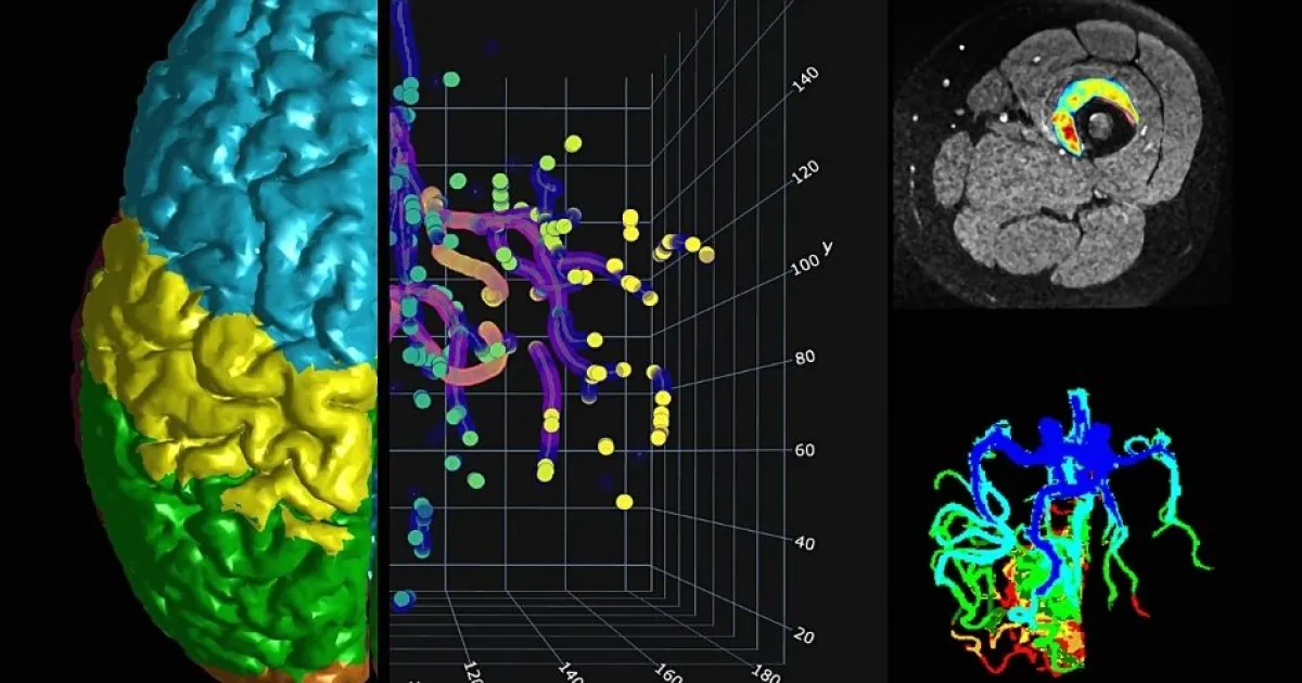 Sant Joan de Déu Research Institute on the EBRAINS platform